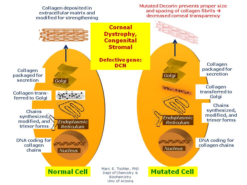 Corneal Dystrophy Congenital Stromal Hereditary Ocular Diseases